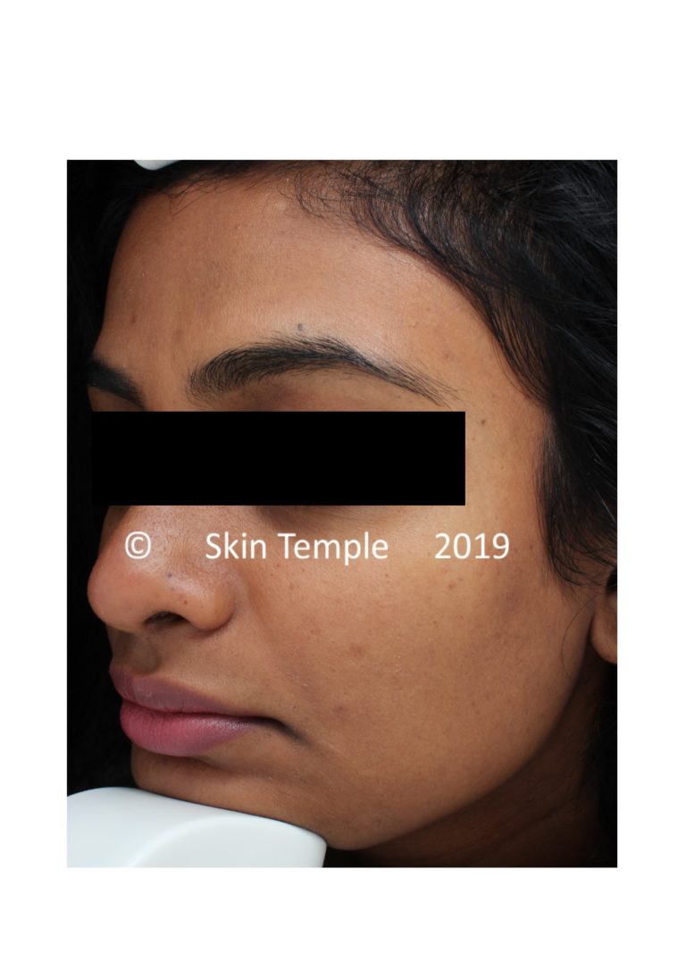 Gallery - Skin Temple