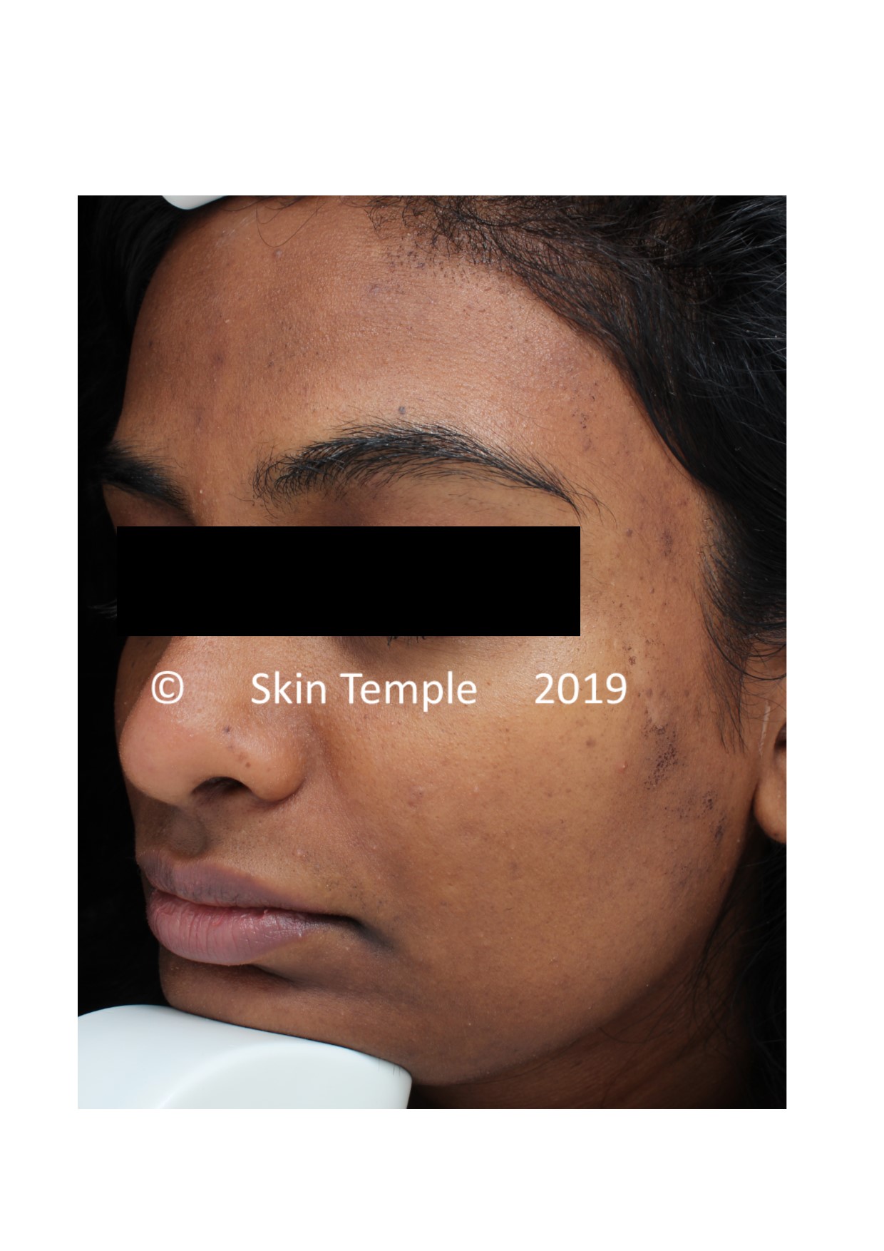 Gallery - Skin Temple