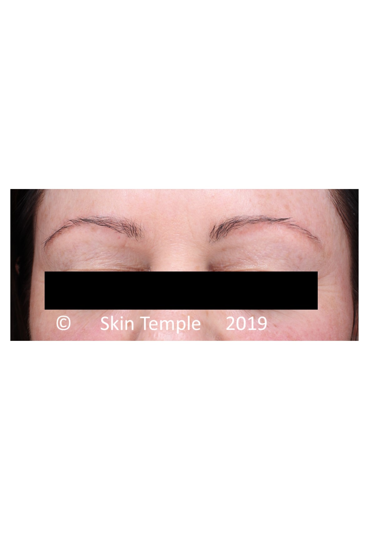 Gallery - Skin Temple