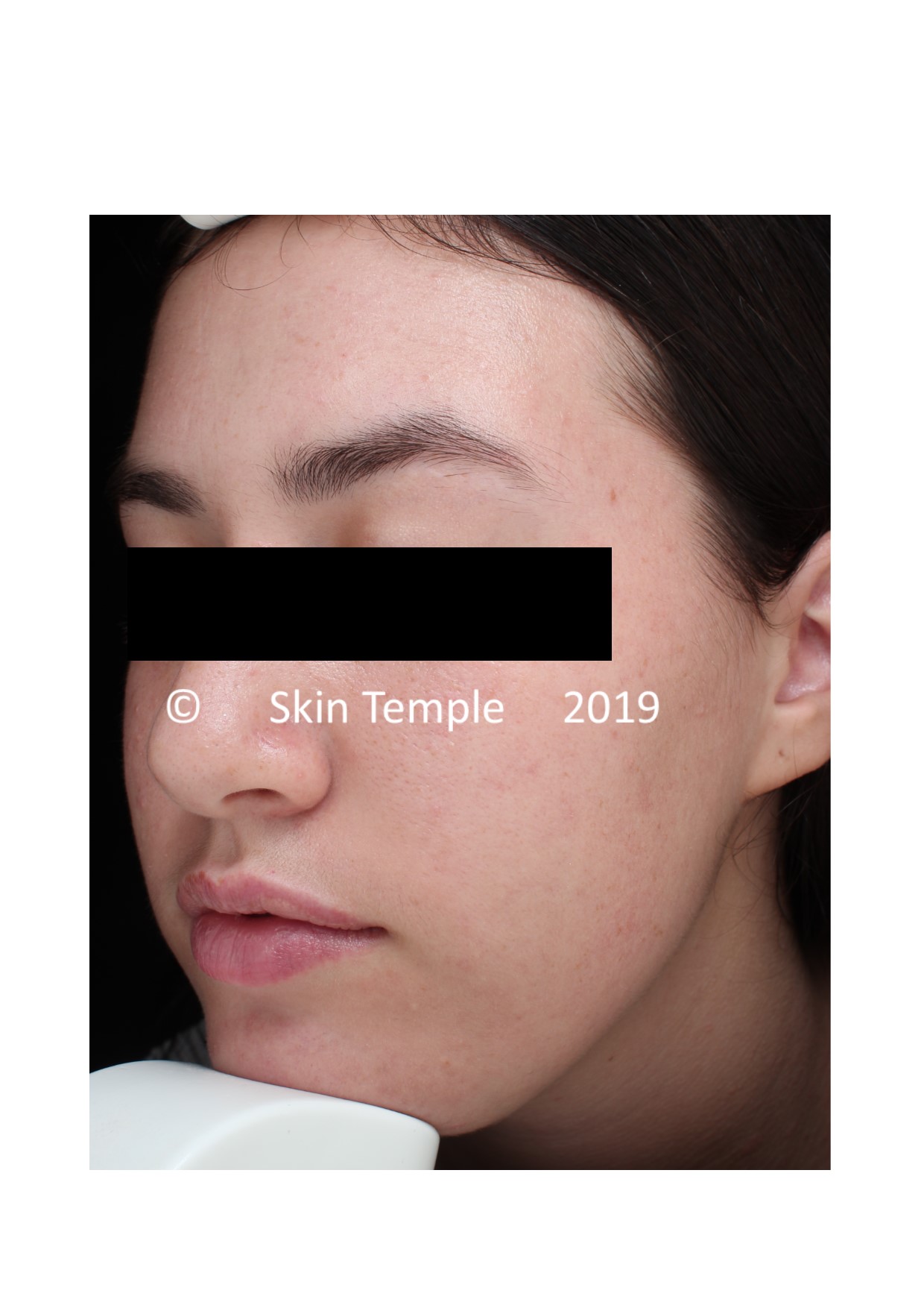 Gallery - Skin Temple