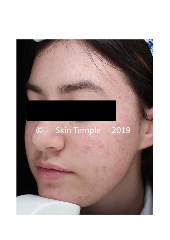 Gallery - Skin Temple