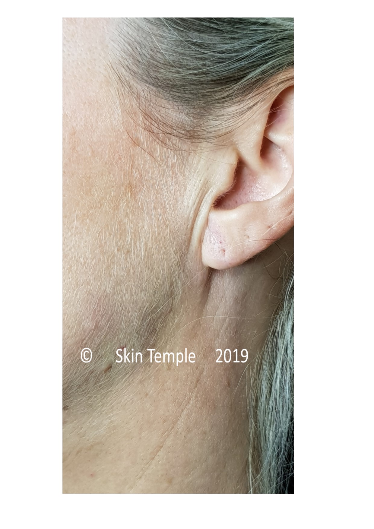 Gallery - Skin Temple
