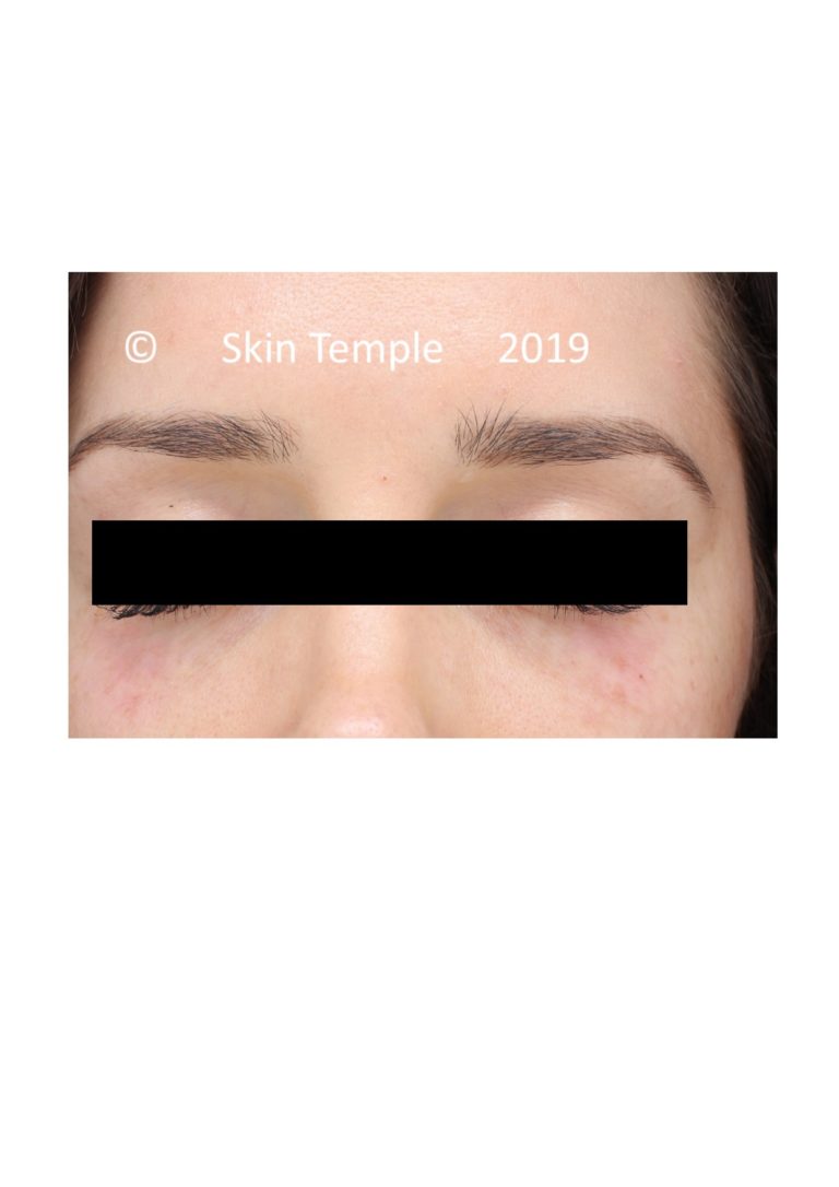 Gallery - Skin Temple