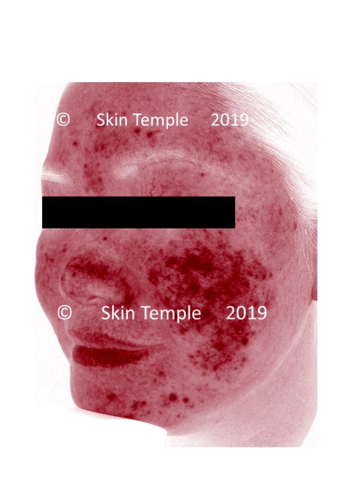 Gallery - Skin Temple