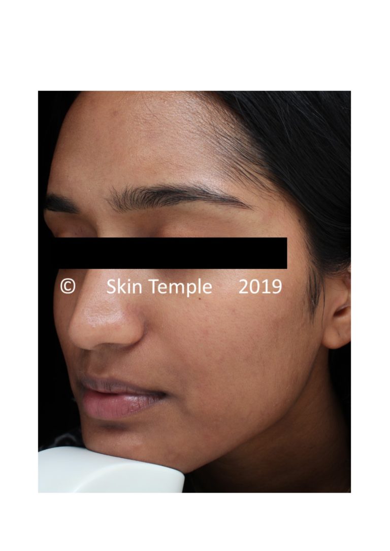 Gallery - Skin Temple