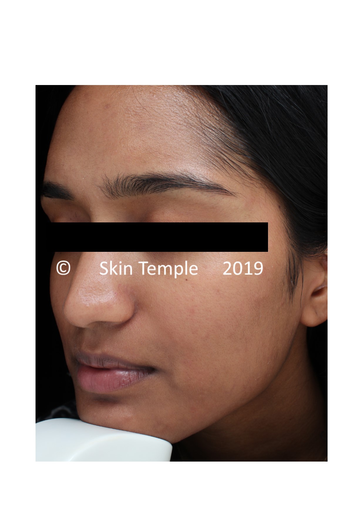 Gallery - Skin Temple