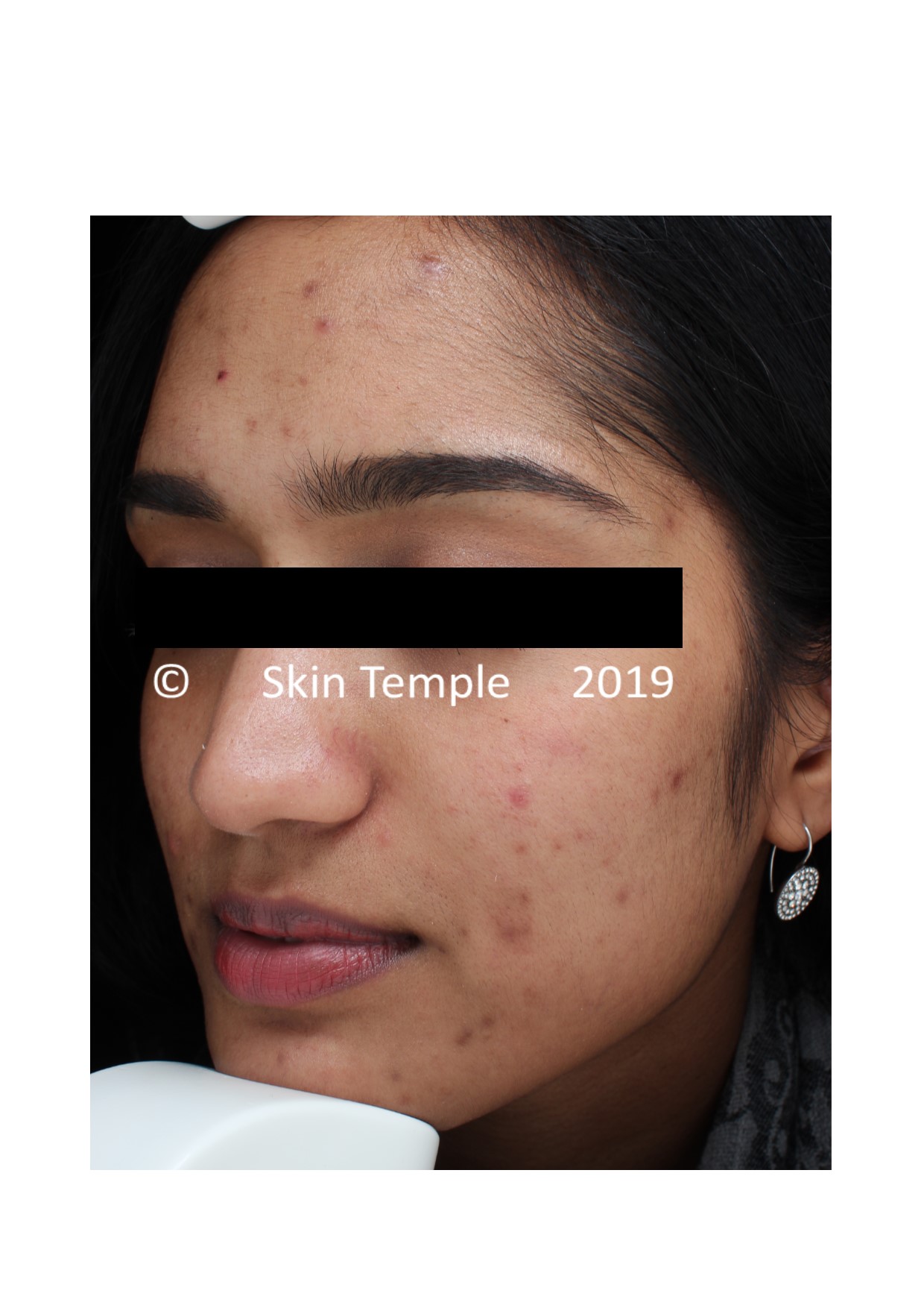 Gallery - Skin Temple