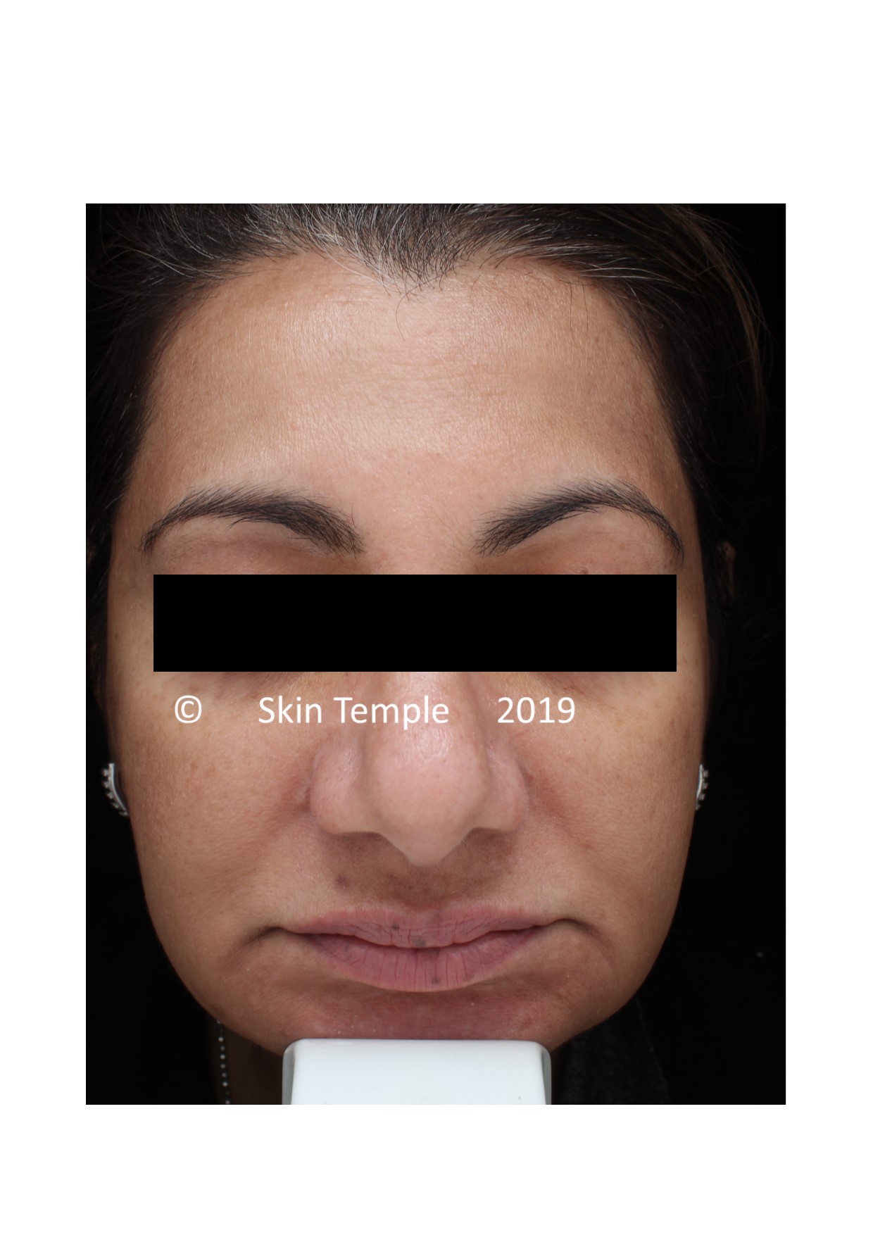 Gallery - Skin Temple