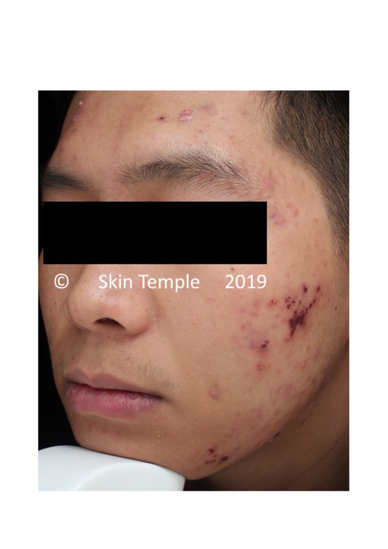 Gallery - Skin Temple