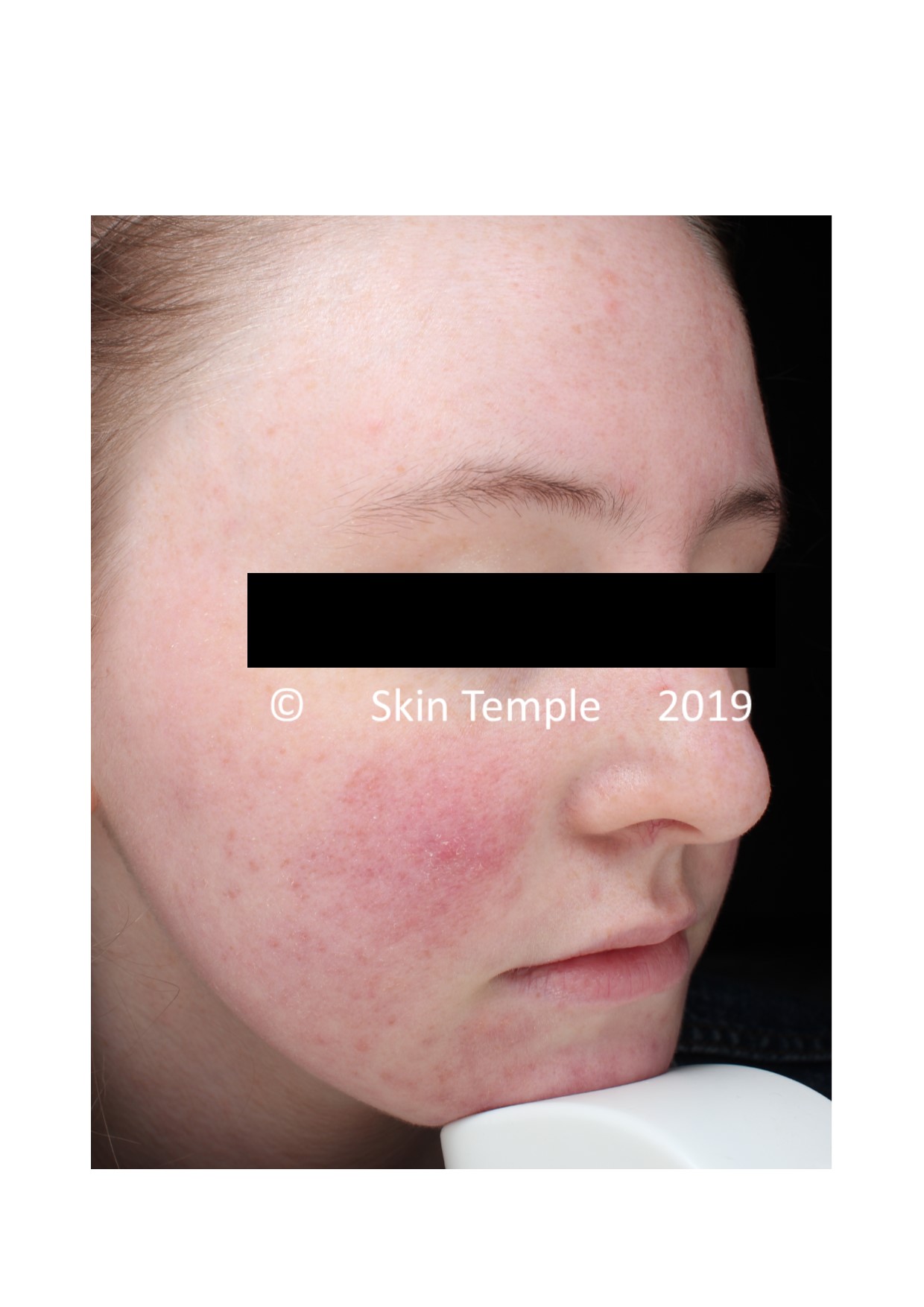 Gallery - Skin Temple