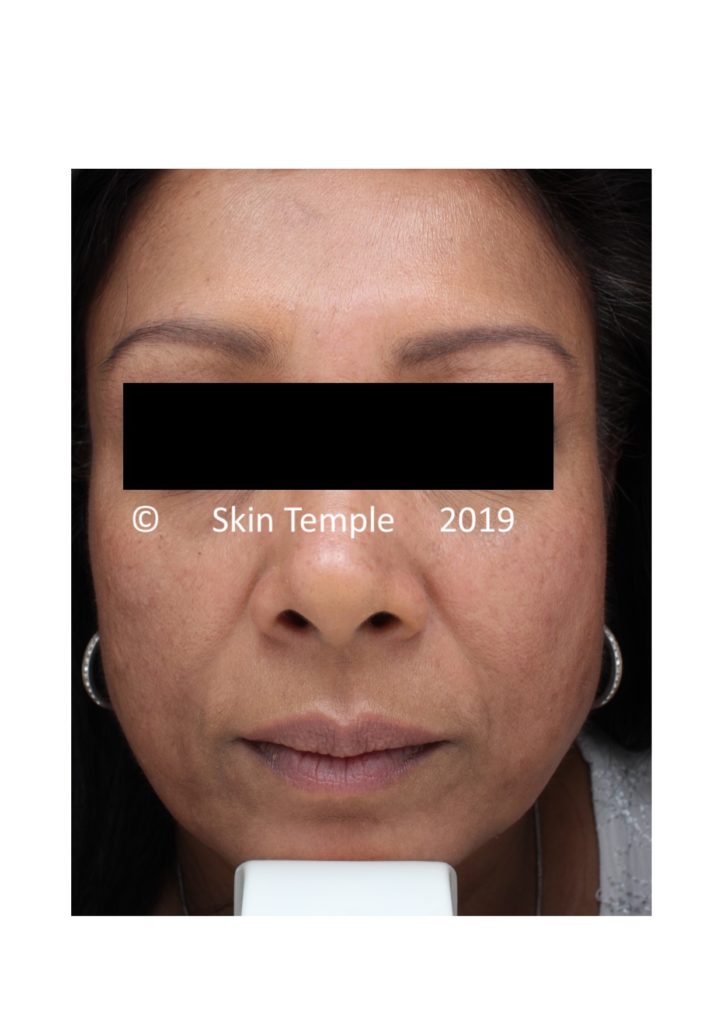 Gallery - Skin Temple