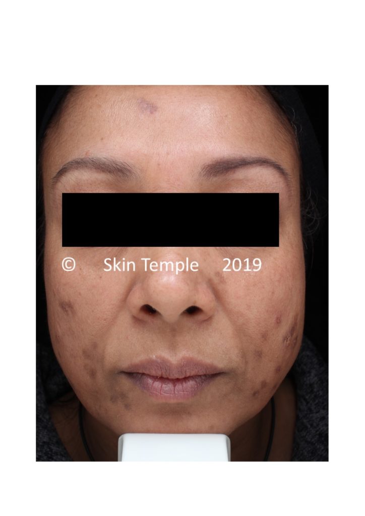 Gallery - Skin Temple