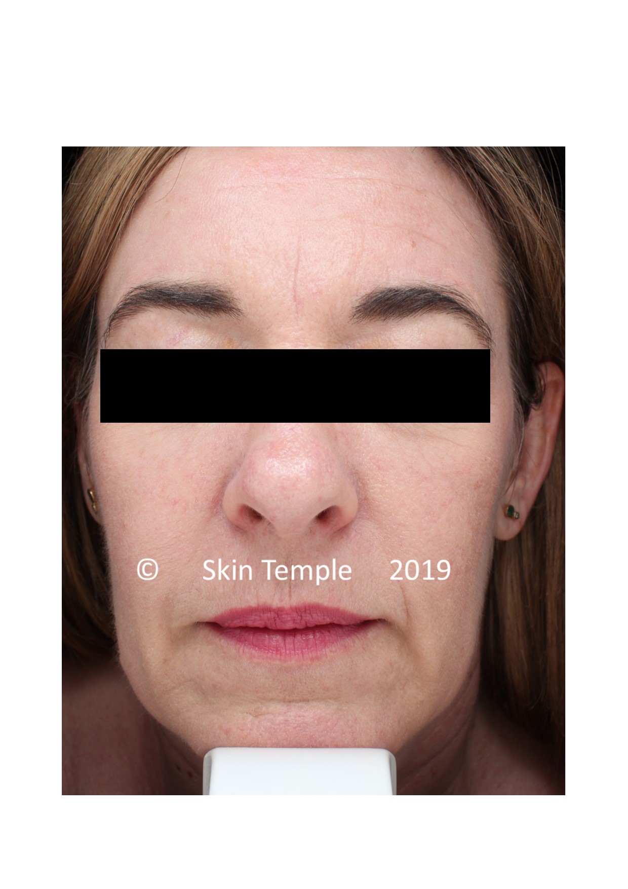 Gallery - Skin Temple