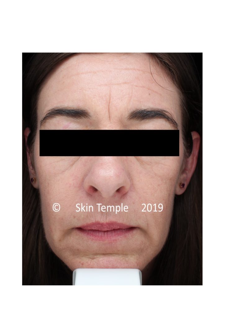 Gallery - Skin Temple