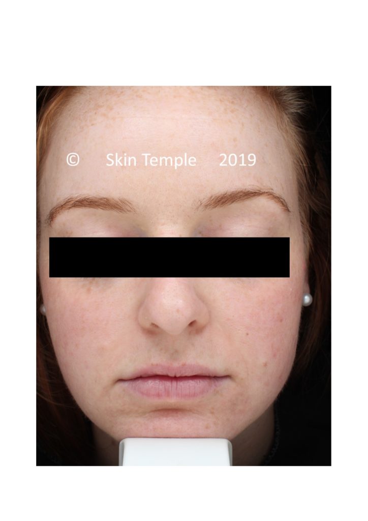 Gallery - Skin Temple