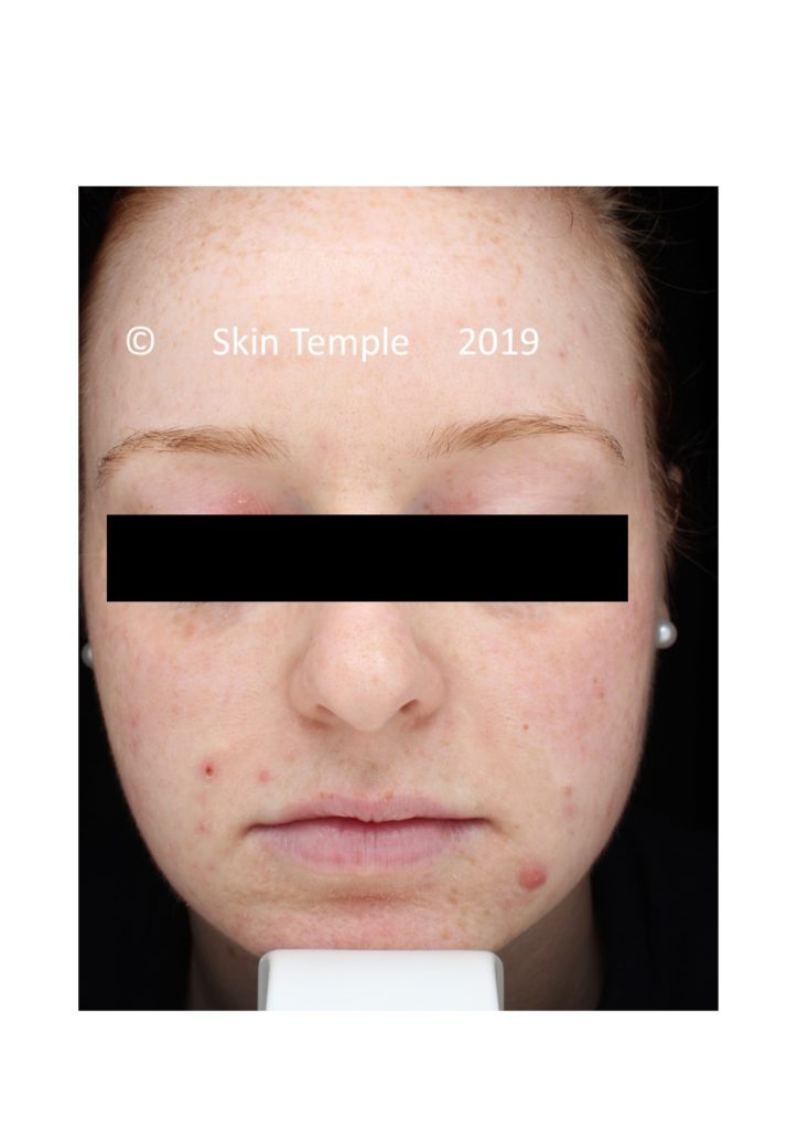 Gallery - Skin Temple