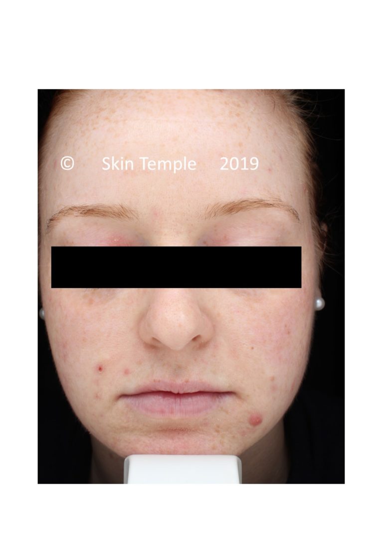 Gallery - Skin Temple