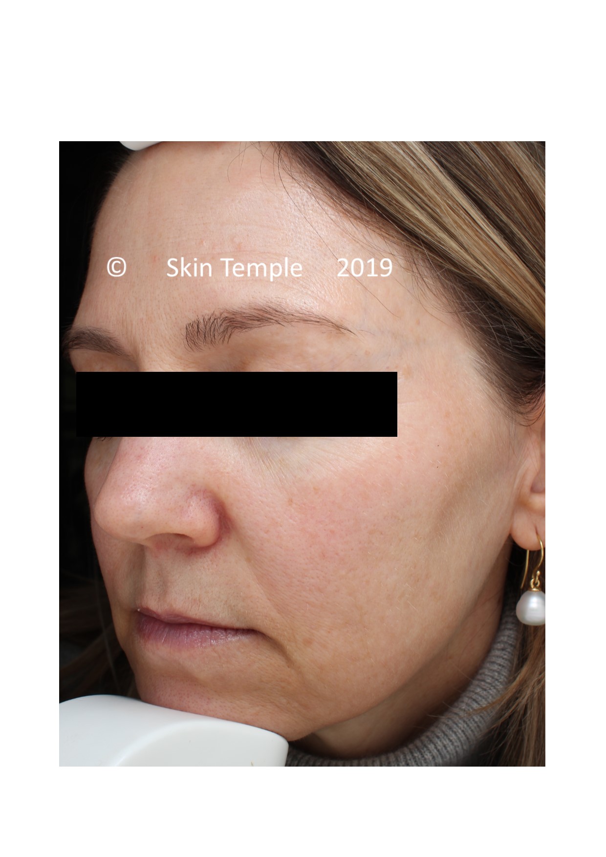 Gallery - Skin Temple