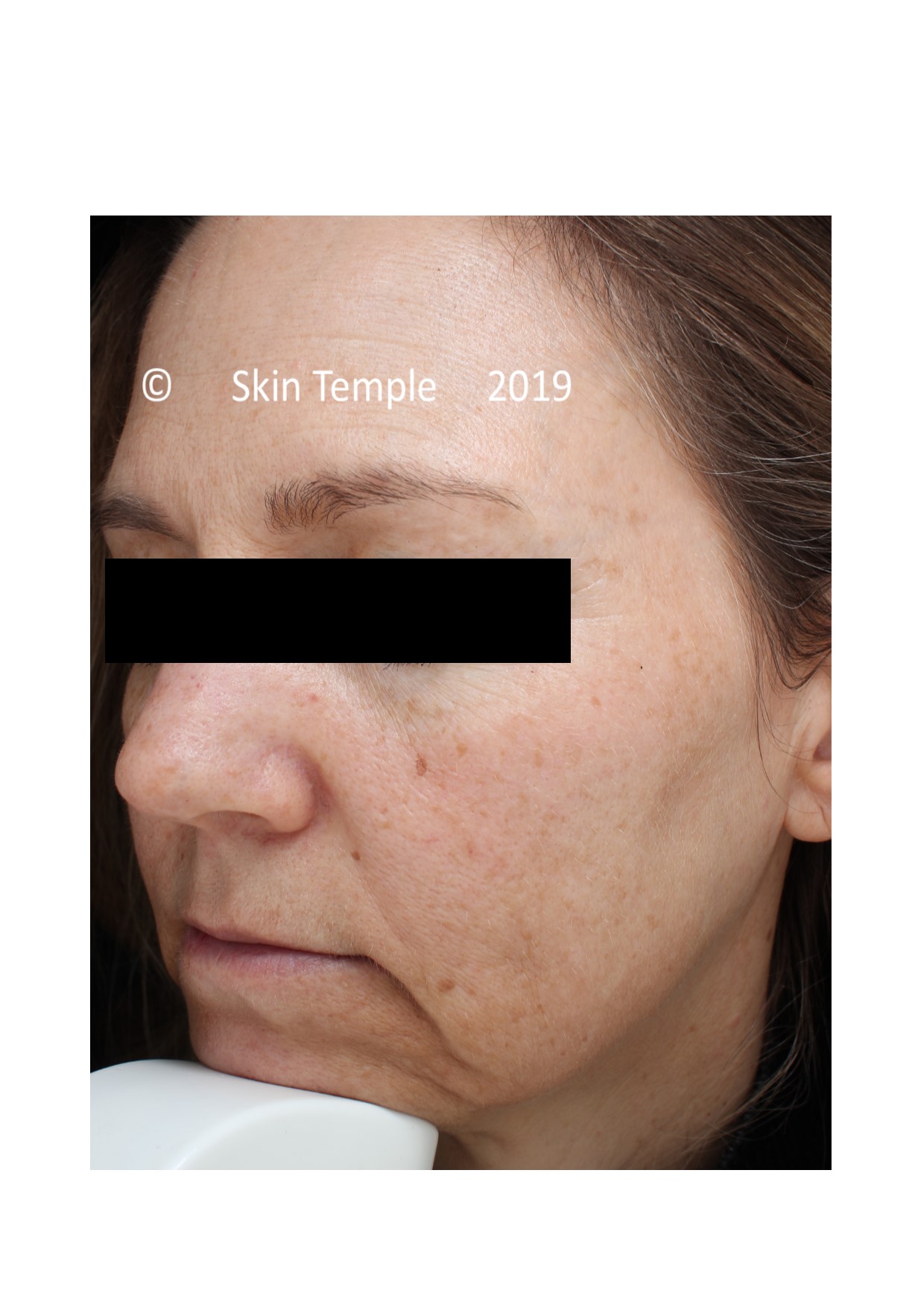 Gallery - Skin Temple