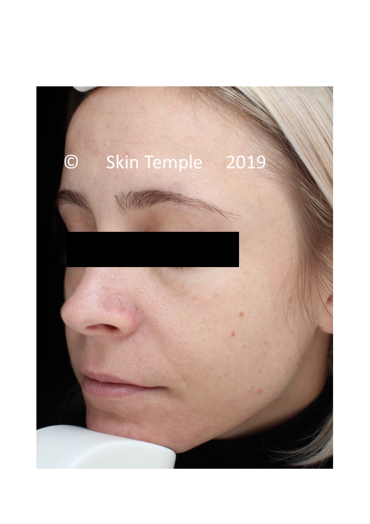 Gallery - Skin Temple