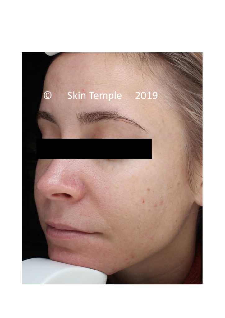 Gallery - Skin Temple